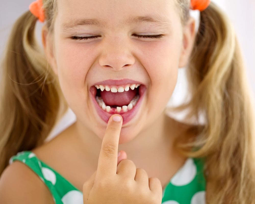 Kids Love Coming Oracle Dental Children s Dentist Gold Coast